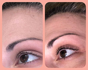 LASHLIFT FILLER | ΚΕΝΤΡΑ ΑΙΣΘΗΤΙΚΗΣ ΘΕΣΣΑΛΟΝΙΚΗ